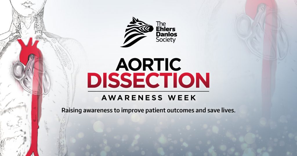 Aortic Dissection: A life-threatening complication - The Ehlers Danlos ...