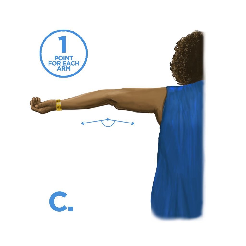 Assessing Joint Hypermobility - The Ehlers Danlos Society