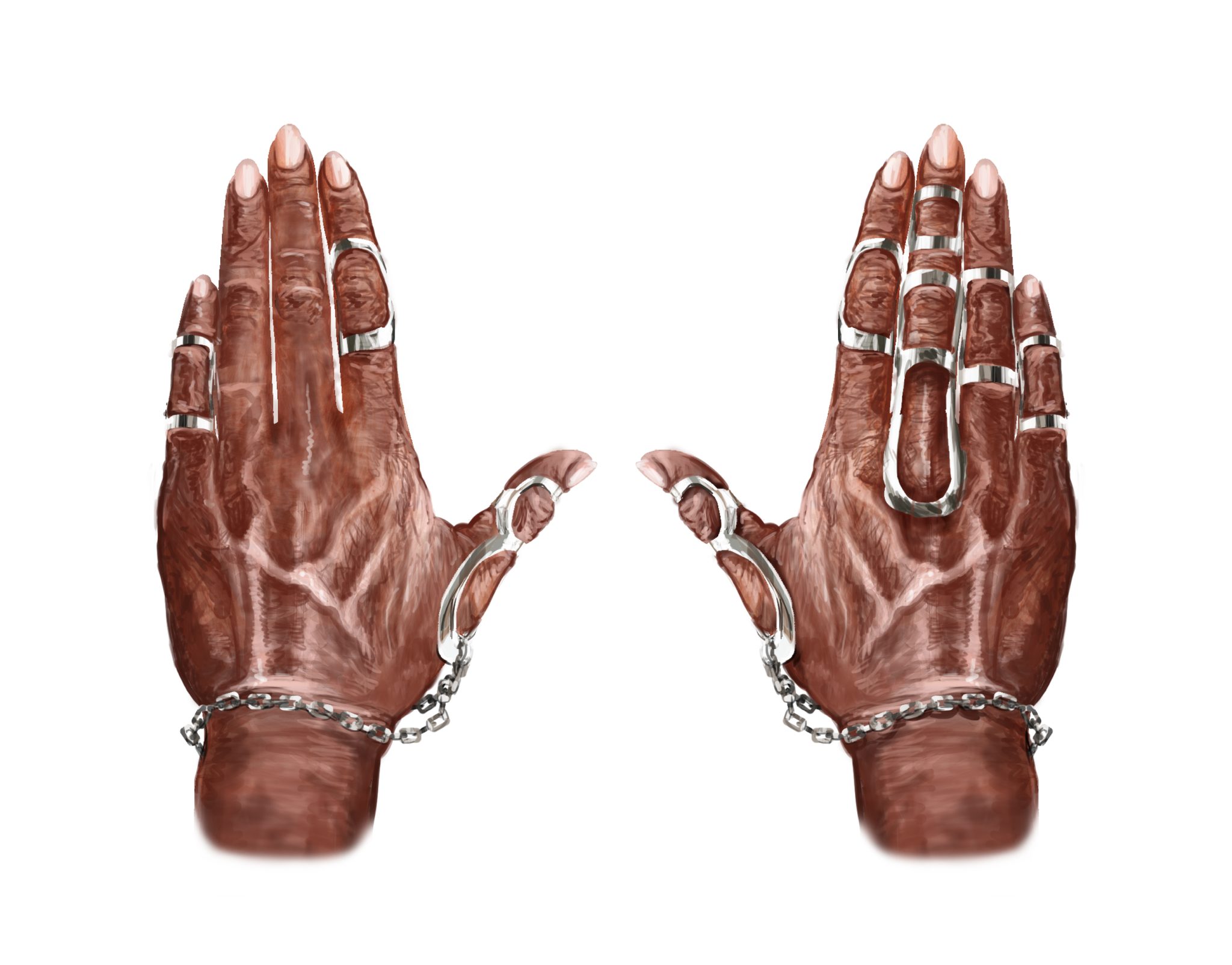 Ring splints for Ehlers-Danlos syndrome & hypermobility spectrum ...