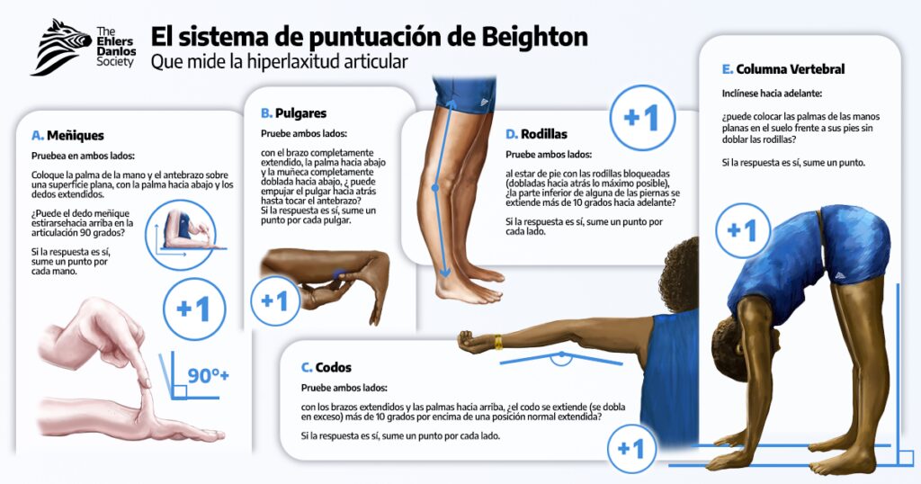 ¿Qué es TEH? - The Ehlers Danlos Society