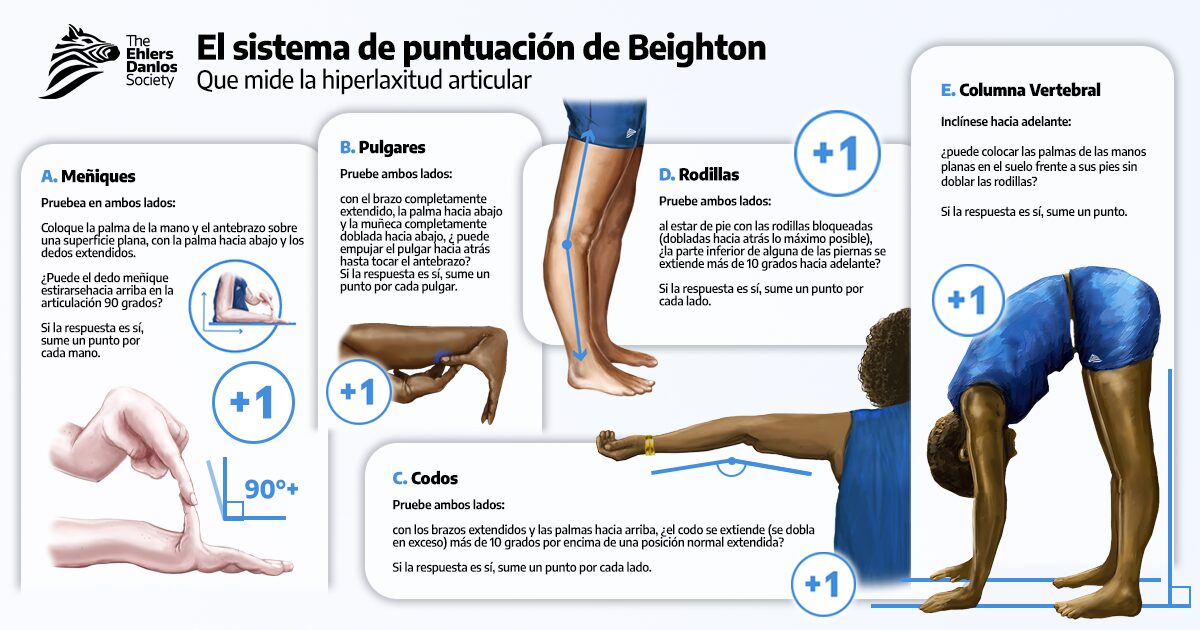 ¿Qué es TEH? - The Ehlers Danlos Society