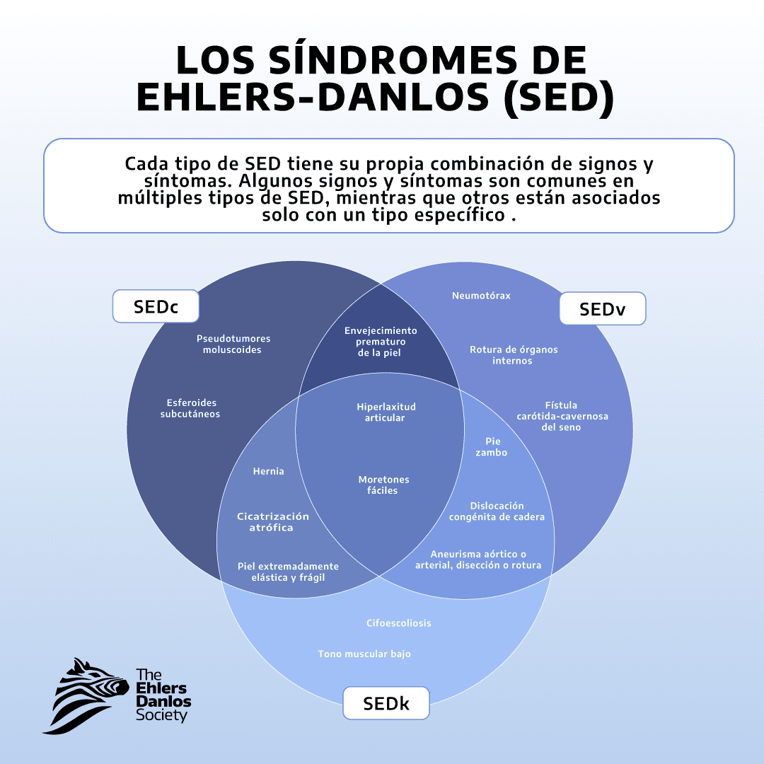 ¿Qué es SED? - La Sociedad Ehlers Danlos